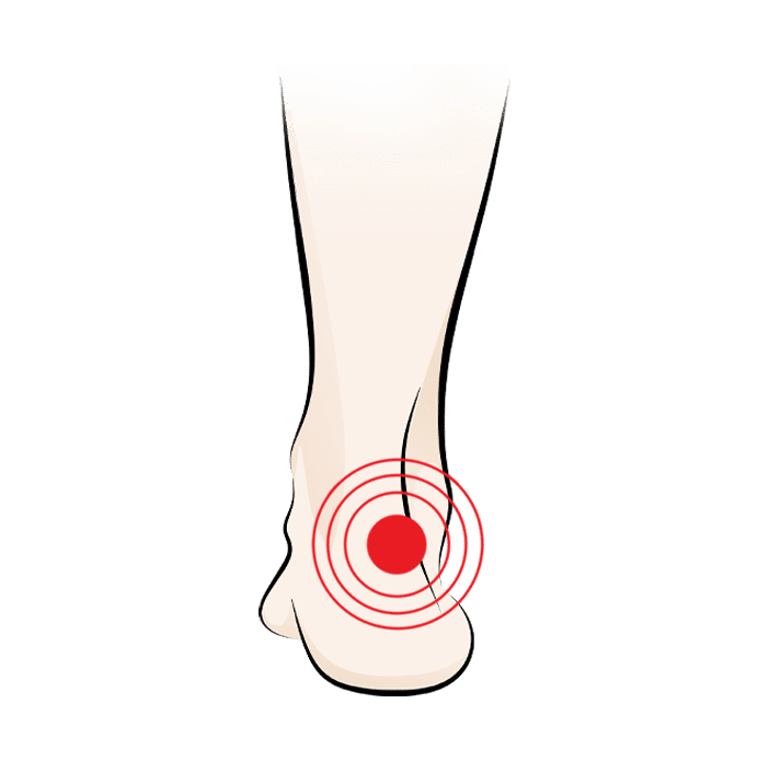 Orthotics » Footlogics Australia » Affordable Orthotic Insoles & Shoes