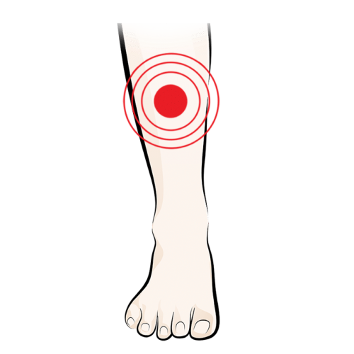 Orthotics » Footlogics Australia » Affordable Orthotic Insoles & Shoes