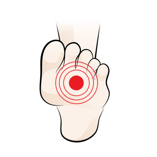 Preventing Foot and Ankle Injuries - Footlogics